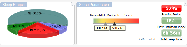 Noxturnal Sleep Study Software – Sleep Software for Sleep Studies