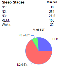 Noxturnal Sleep Study Software – Sleep Software for Sleep Studies
