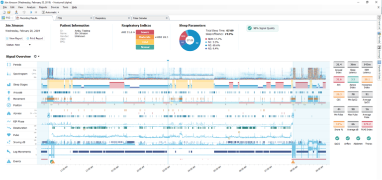 The Nox T3s™ Combines Clinical Accuracy and Simplicity - Nox Medical